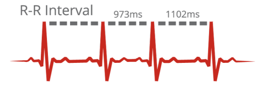 What are R-R intervals? - Elite HRV Knowledge Base